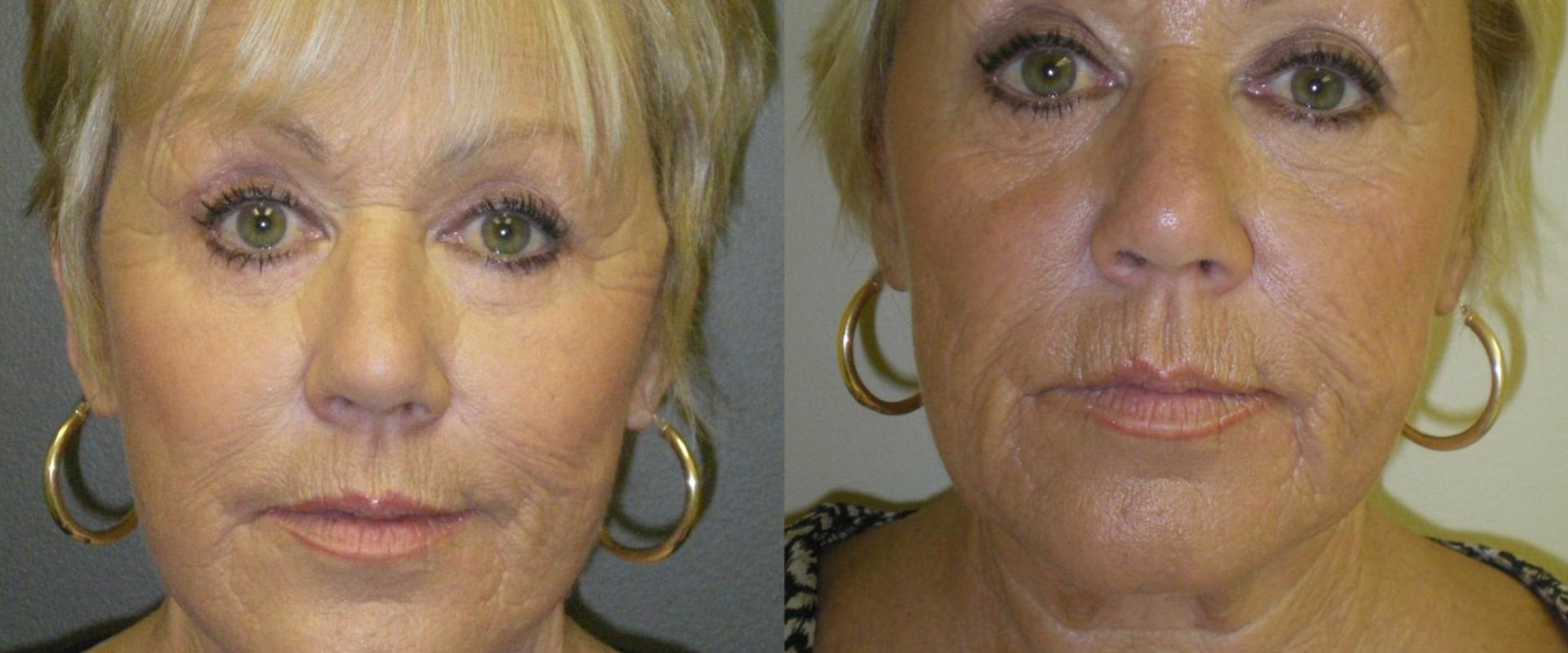 Plastic Surgery Near Me Plastic Surgery Near Me